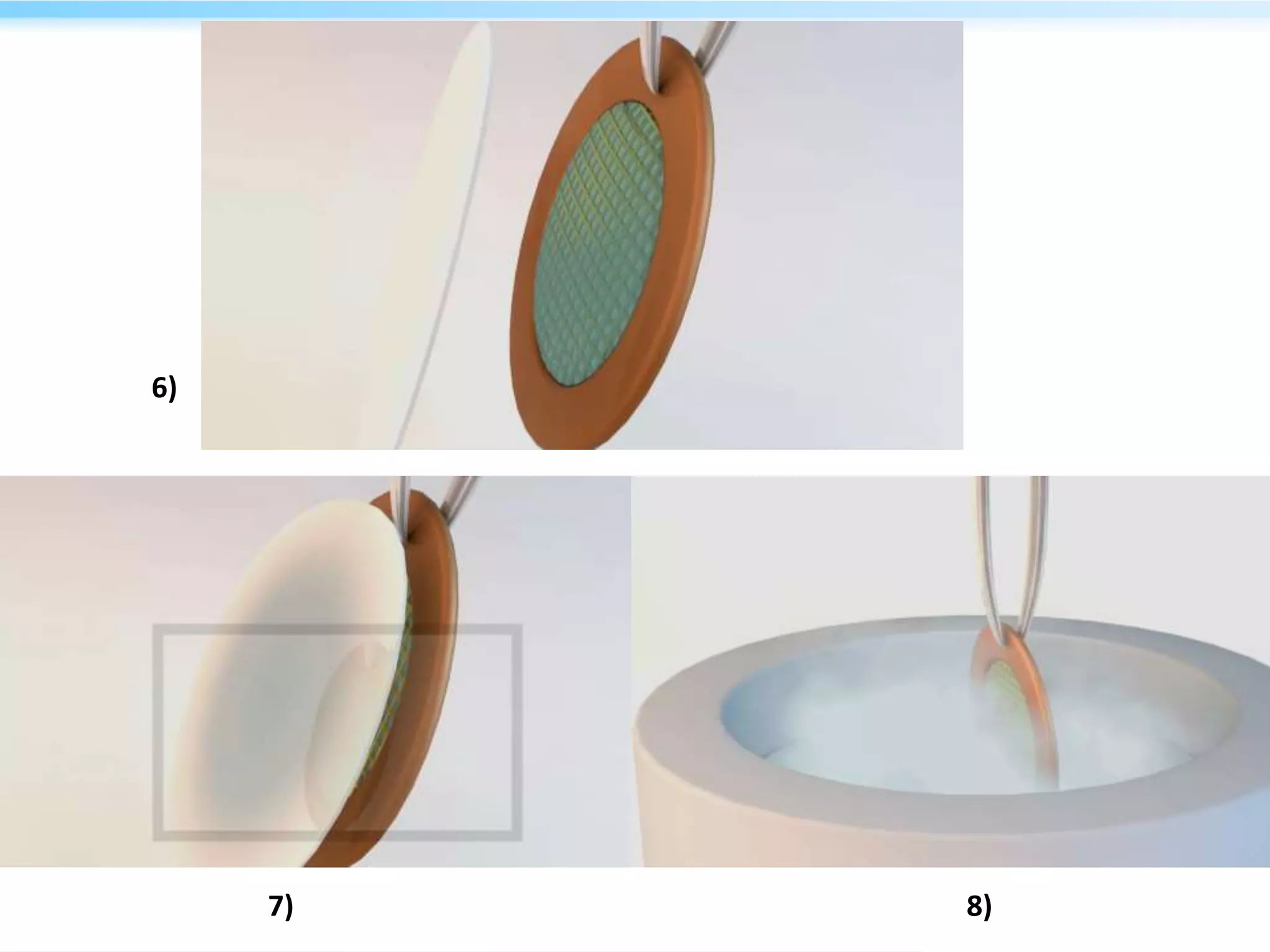 Cryo electron microscopy | PPTX