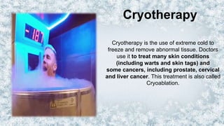 cryogenics.pptx
