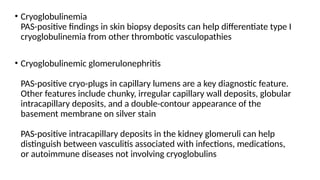 CRYOGLOBULINEMIA and its pathophysiology | PPTX