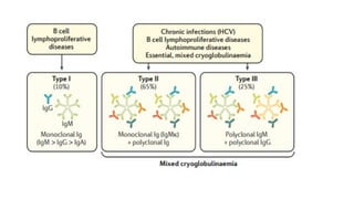 CRYOGLOBULINEMIA and its pathophysiology | PPTX