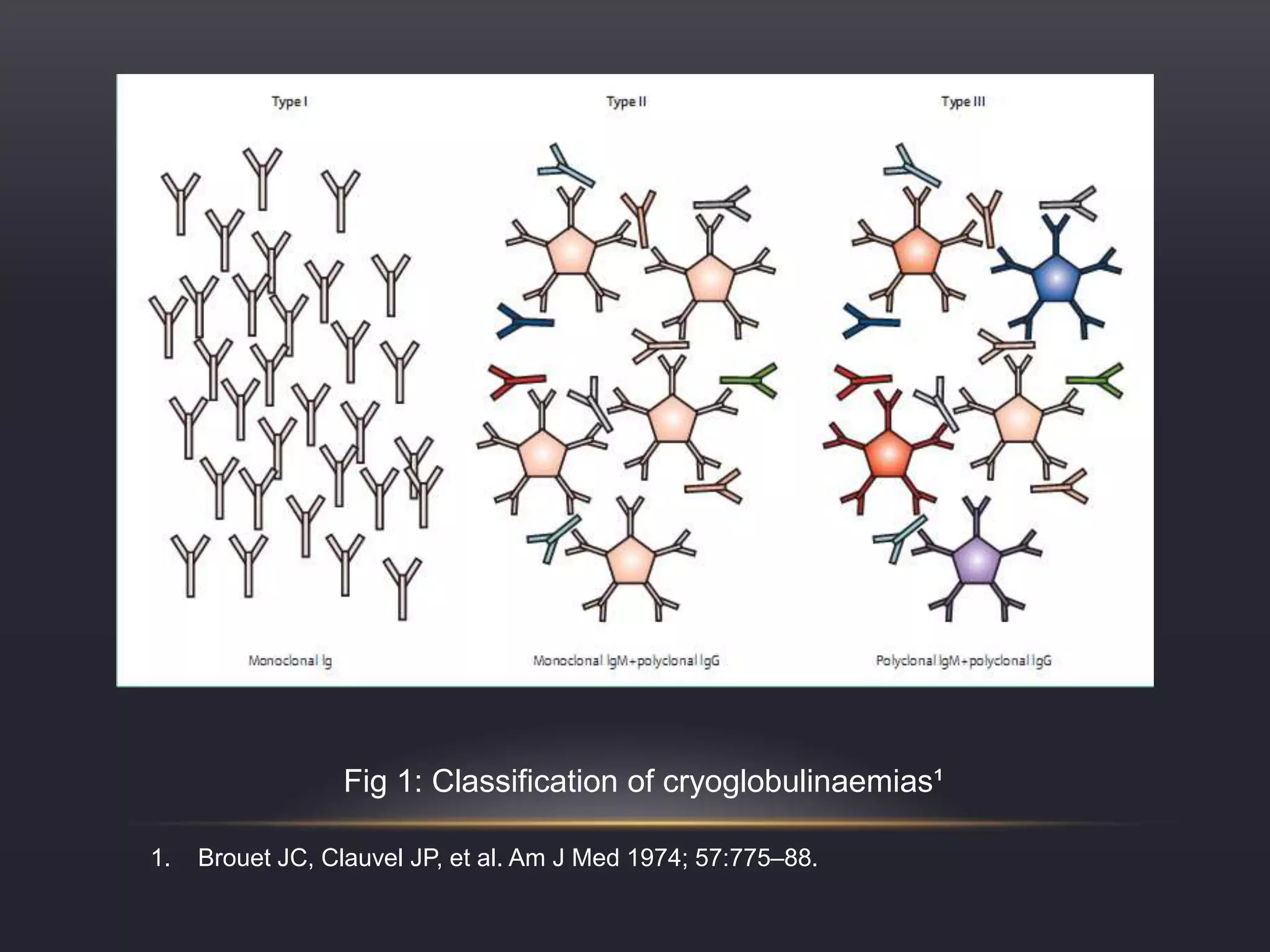 Cryoglobulinemia ppt | PPTX