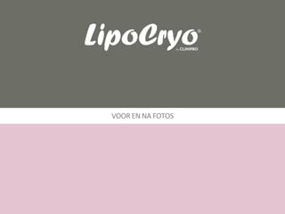 Cryolipolyse lipo cryo voor_na | PPTX
