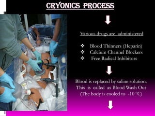 Cryonics - A Science Fiction | PPTX