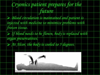 Cryonics | PPT | Chemistry | Science
