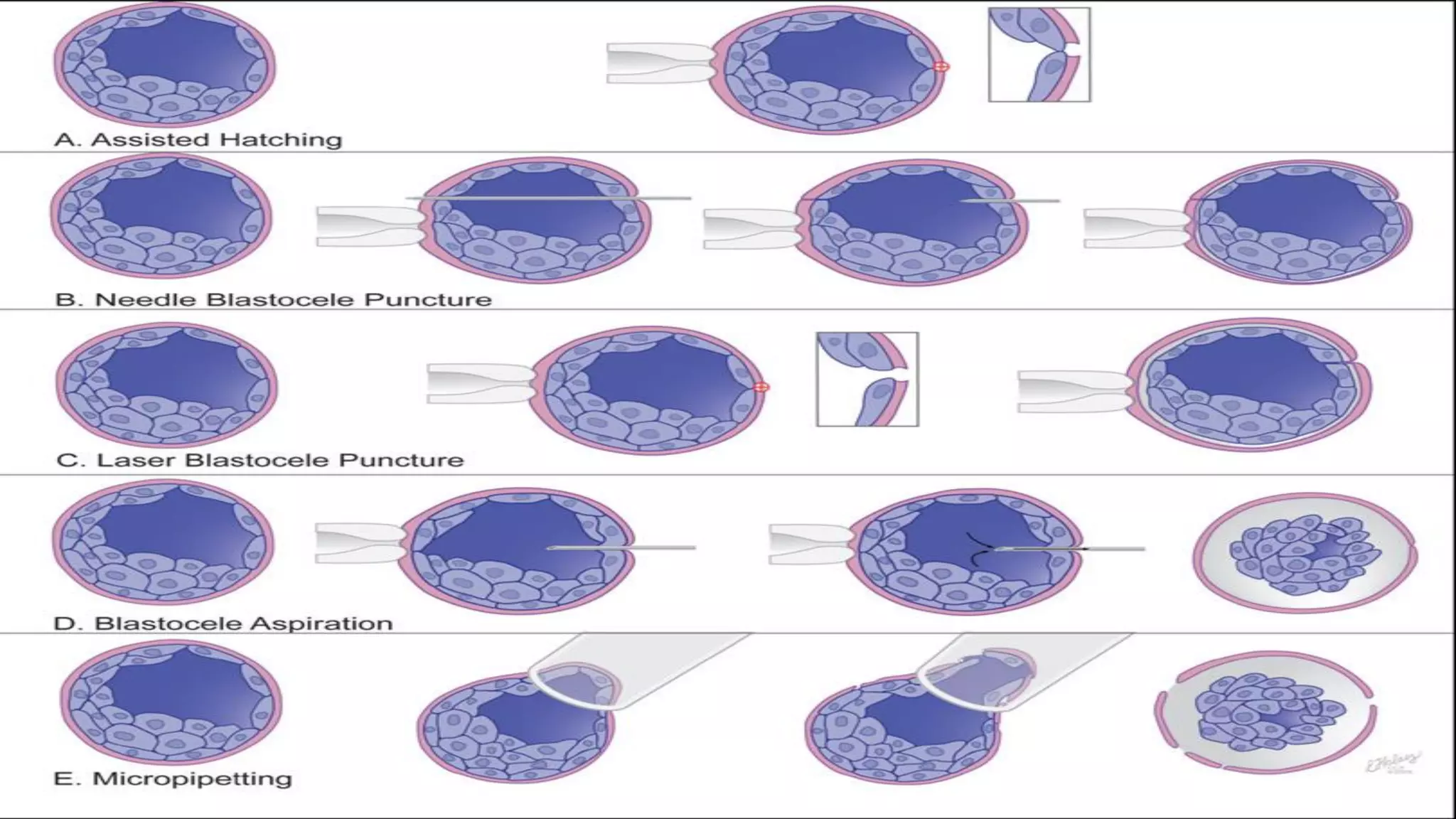 An Overview on Embryos Cryopreservation & Vitrification | PDF
