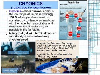 Cryopreservation dk final present | ODP