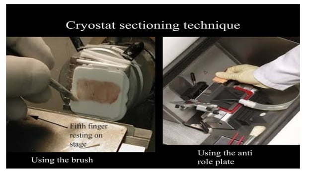 cryostat histopathology automation .pptx