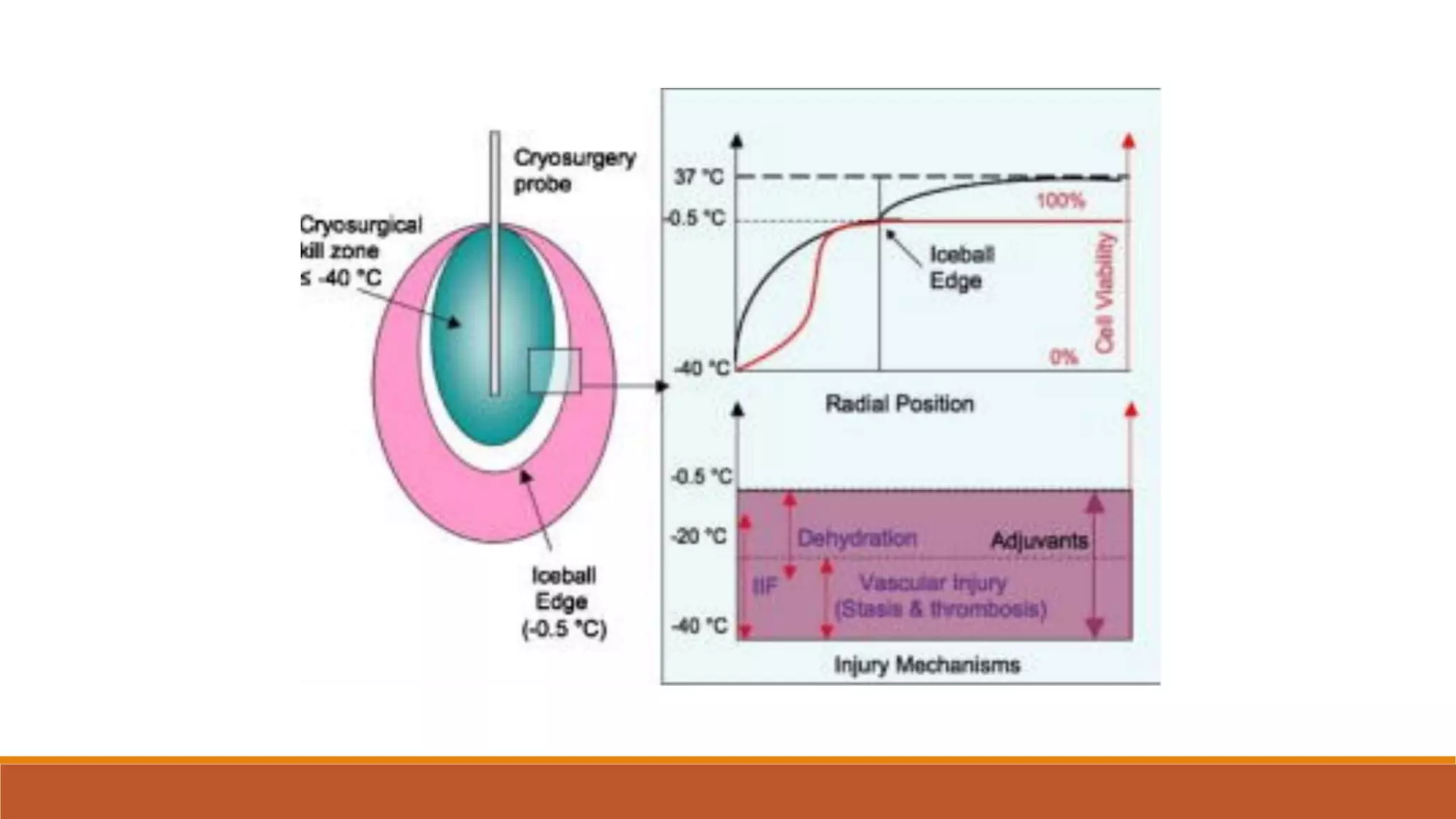 Cryosurgery | PPTX