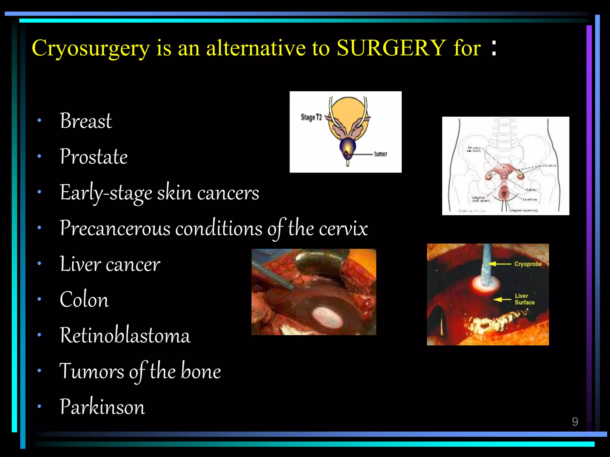Cryosurgery & Cryotherapy | PPTX