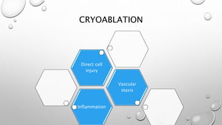 Cryosurgery Dr Manasa Shettisara Janney | PPTX