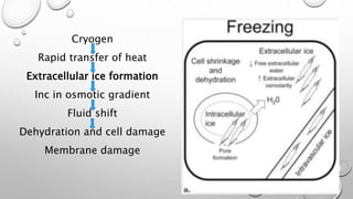 Cryosurgery Dr Manasa Shettisara Janney | PPTX