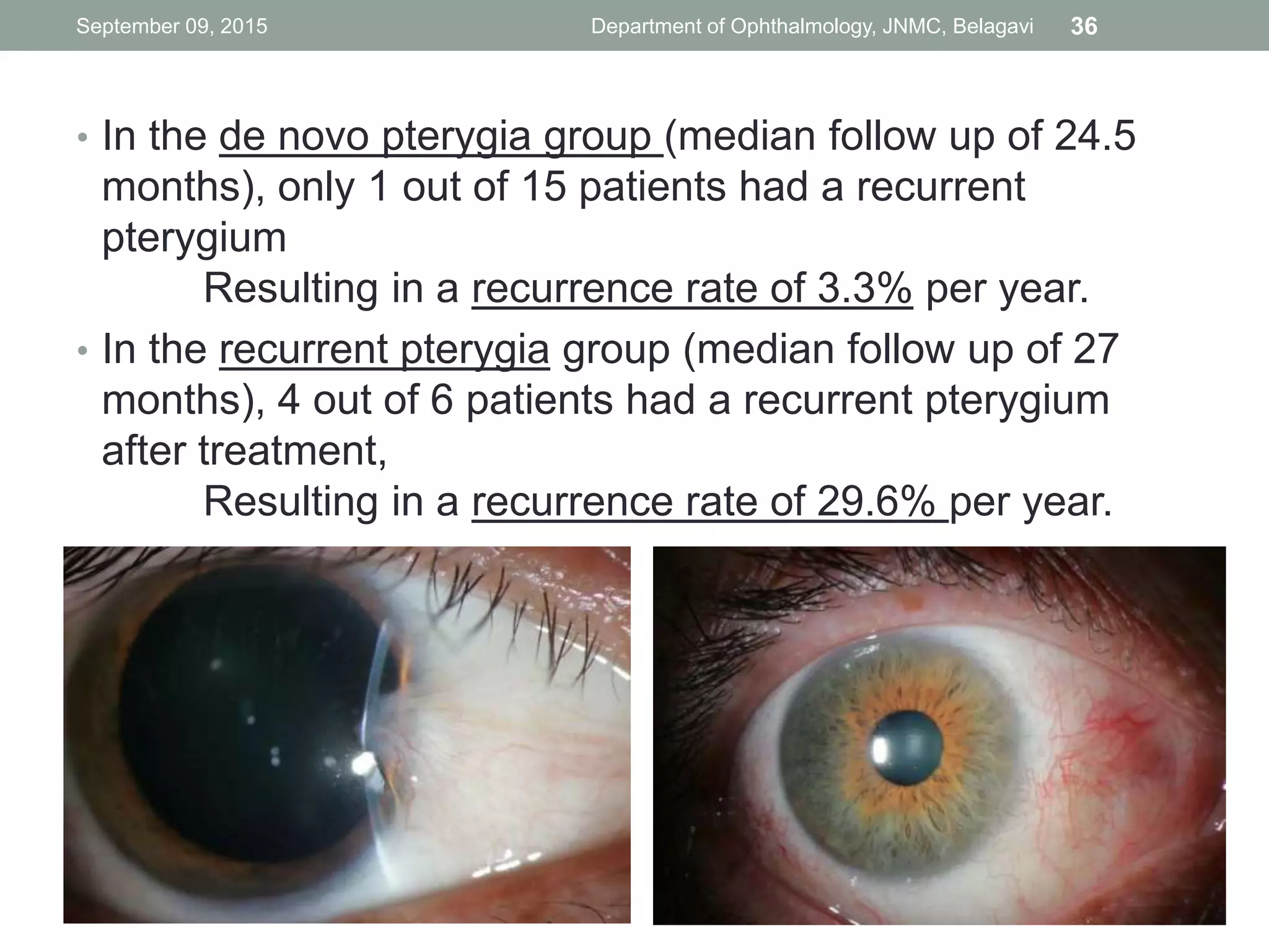 Cryotherapy in Ophthalmology | PPTX
