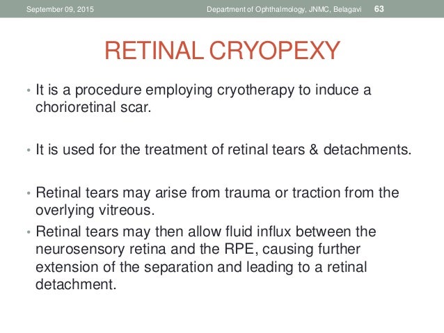 Cryotherapy in Ophthalmology