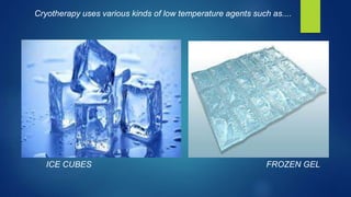 Cryotherapy | PPTX