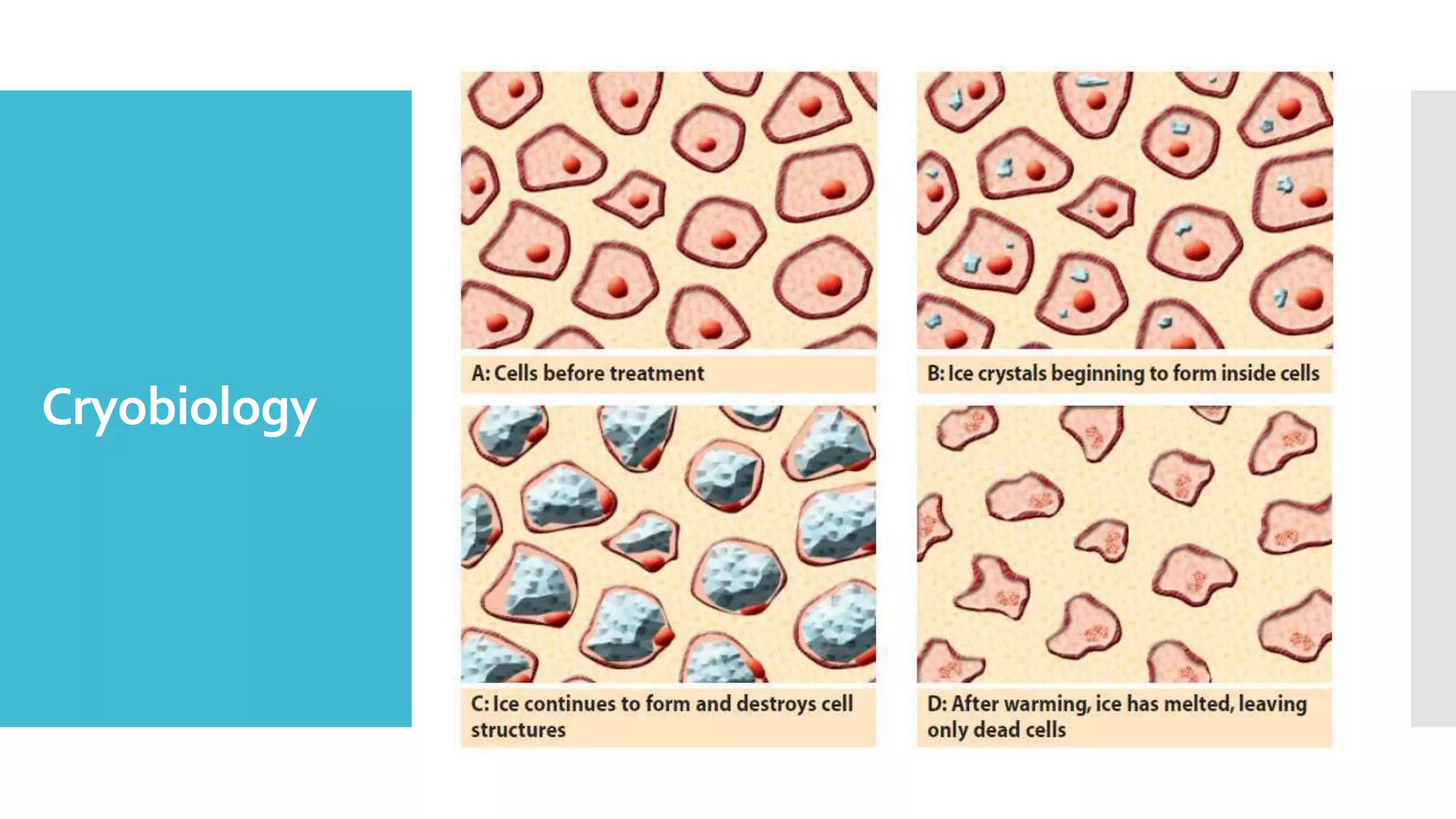 Cryotherapy and its implications in Oral surgery | PPTX