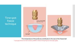 Cryotherapy and its implications in Oral surgery | PPTX