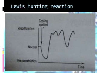 Cryotherapy in Physiotherapy | PPTX