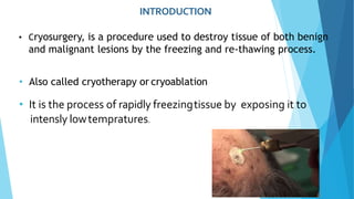 Cryotherapy In OMFS | PPTX
