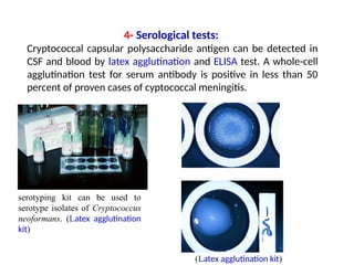 Crypt-Mucor-Penicil.-Pneumo-2021 short.pptx