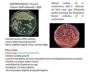 Crypt-Mucor-Penicil.-Pneumo-2021 short.pptx