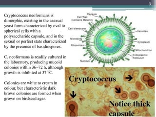 Cryptococcus Neoformans Meningitis