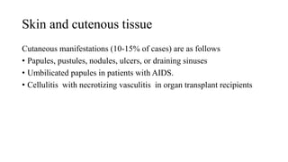 Cryptococcal meningitis.pptx
