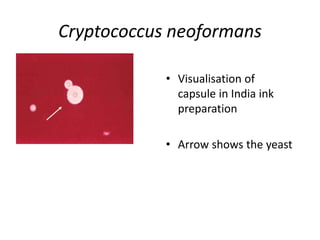 Cryptococcosis.pptx