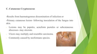 Cryptococcosis | PPTX