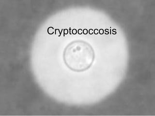Cryptococcosis neetu | PPT