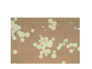 Cryptococcus | PPTX