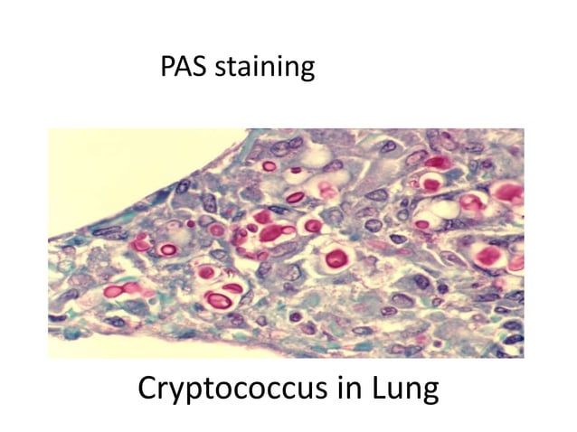 Cryptococcus | PPTX