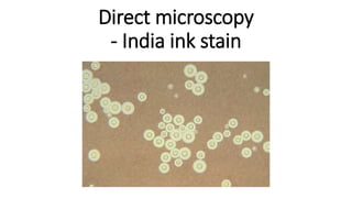 Cryptococcosis | PPTX