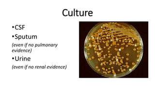Cryptococcus Culture