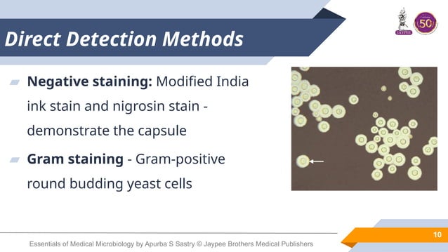 cryptococcus.pptxcryptococcus.pptxcryptococcus.pptx