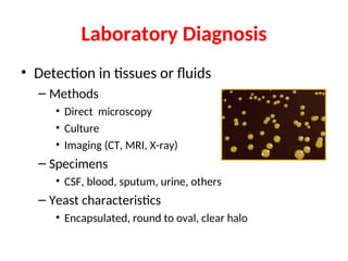 Cryptococcus. var. gattii, var. neoformans and var. grubii. | PPT