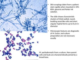 Cryptococcus and Malassezia of veterinary importance | PPT