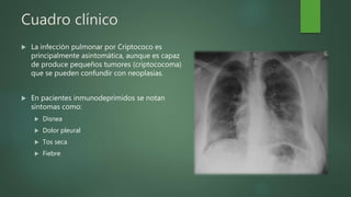 Cryptococcus neoformans | PPTX