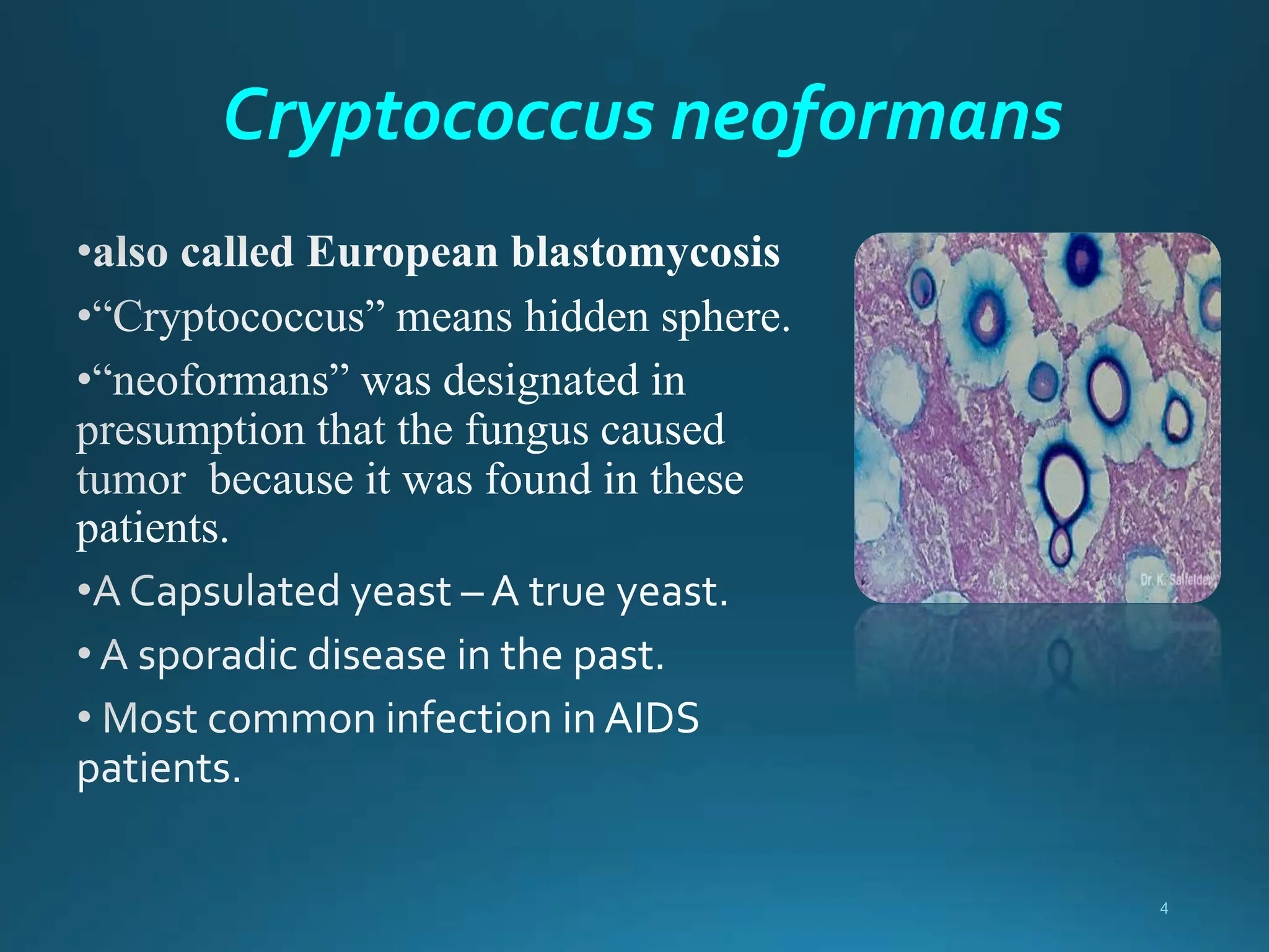 Cryptococcus neoformans for bmit class.pptx