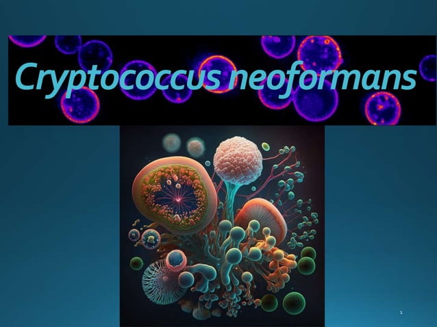 Cryptococcus neoformans for bmit class.pptx