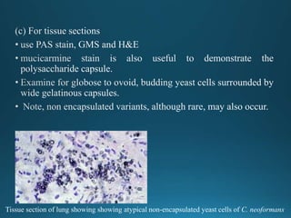 Cryptococcus neoformans for bmit class.pptx