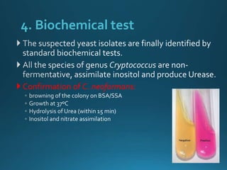 Cryptococcus neoformans for bmit class.pptx