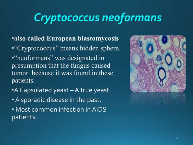 Cryptococcus neoformans for bmit class.pptx