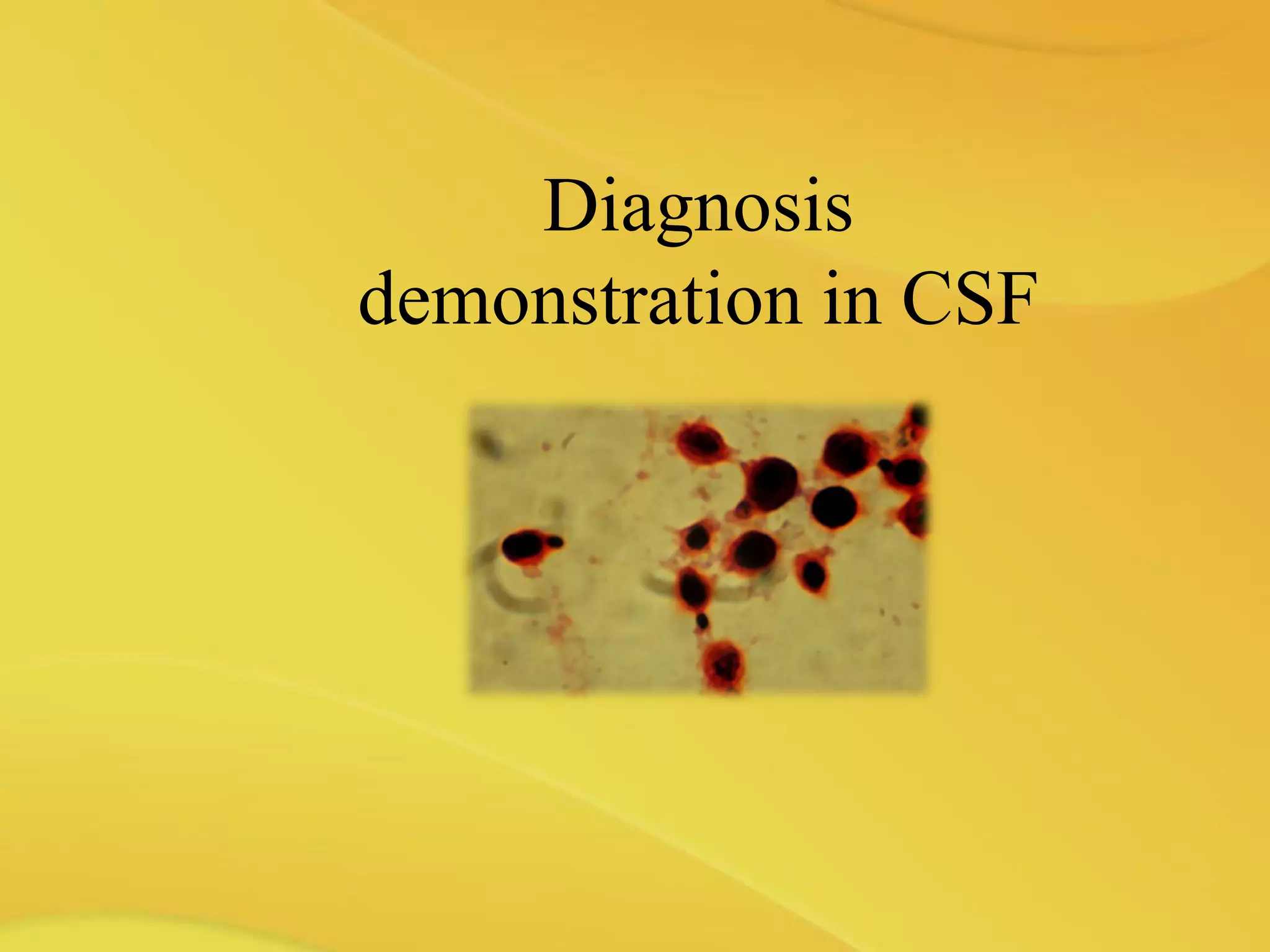 Cryptococcus neoformans infection.pdf
