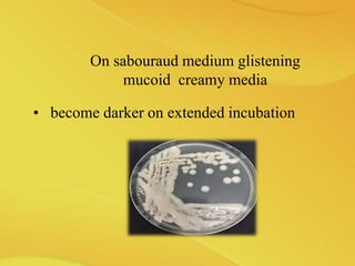 Cryptococcus neoformans infection.pdf