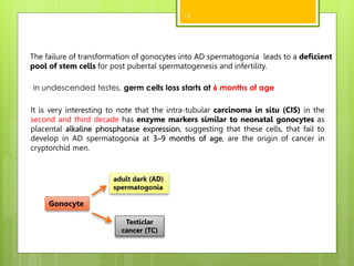 Undescended Testis- Cryptorchidism | PPTX