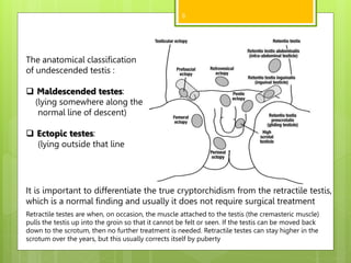 Undescended Testis- Cryptorchidism | PPTX