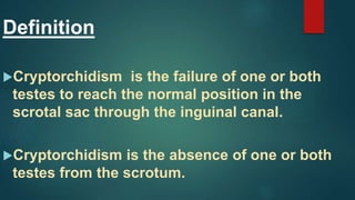 Cryptorchidism | PPT