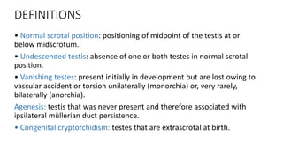 Cryptorchidism | PPTX