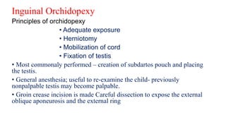 Cryptorchidism | PPTX