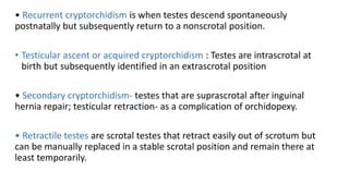 Cryptorchidism | PPTX